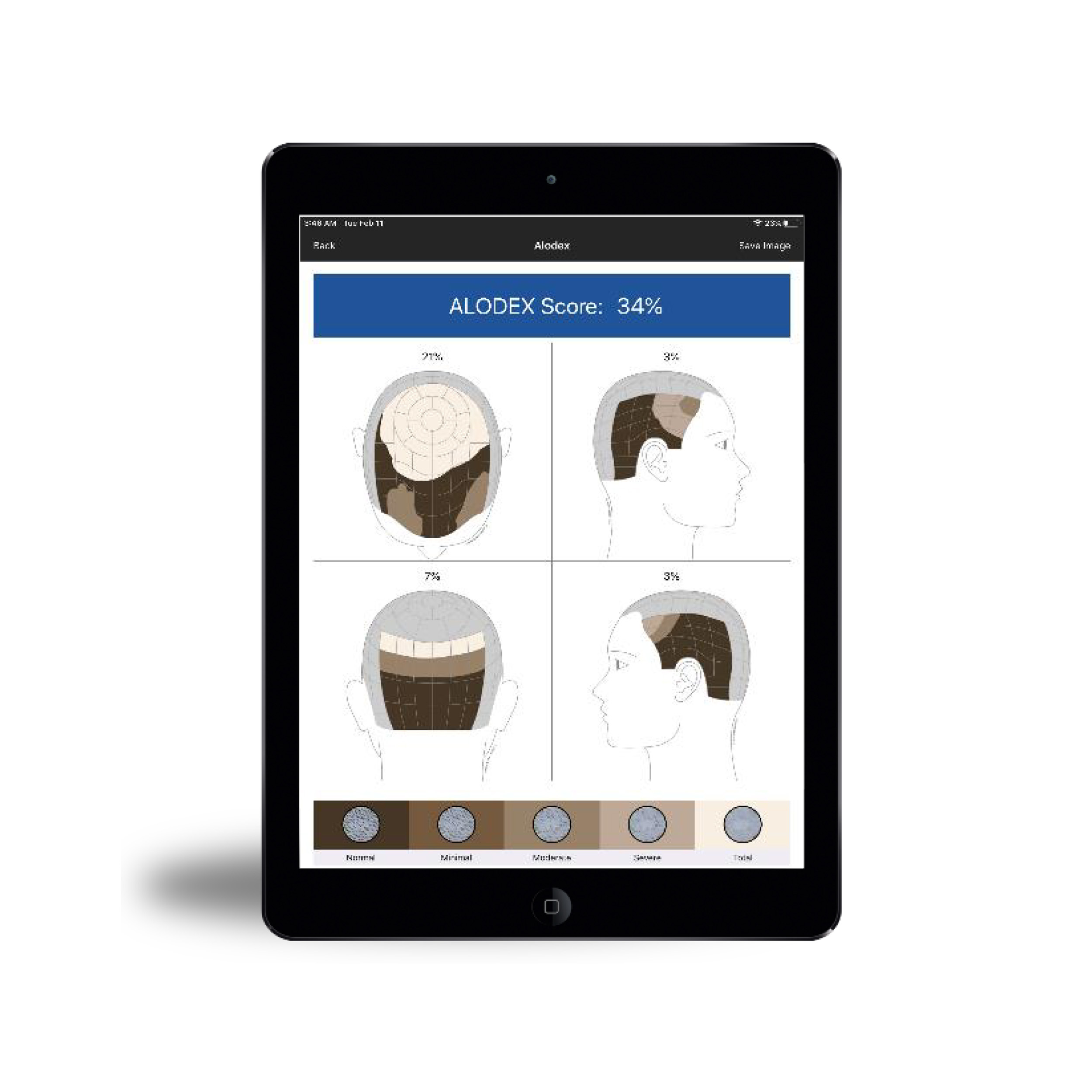 Hairmetrix - Medsystems